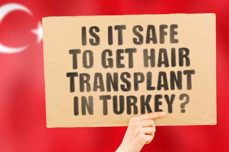 TURKISH HAIRLINES: THE TRUTH BEHIND THE VIRAL TREND - Island Echo ...