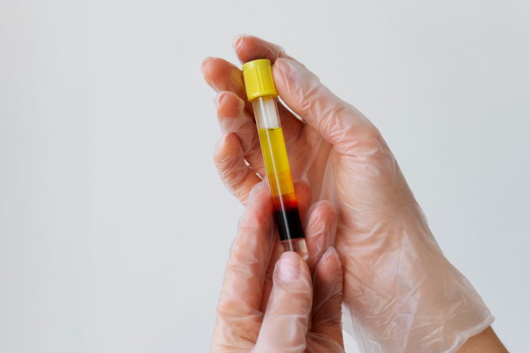 BLOOD PLASMA STORAGE TEMPERATURE REQUIREMENTS: WHAT FACILITIES NEED TO ...